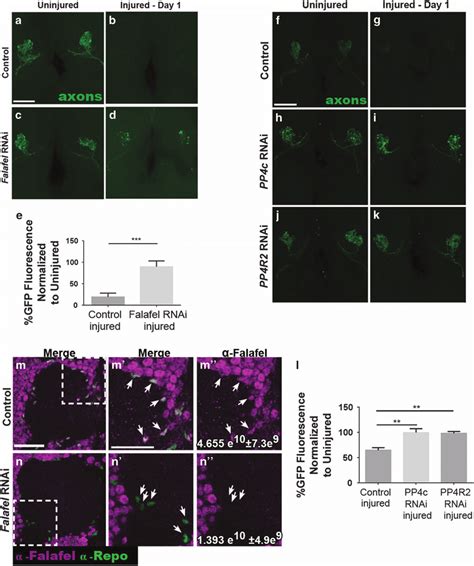 The Pp4 Complex Subunits Falafel Pp4c And Pp4r2 Are Required For Download Scientific Diagram