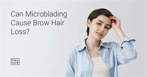 Microneedling Depth Guide Through Areas And Concerns