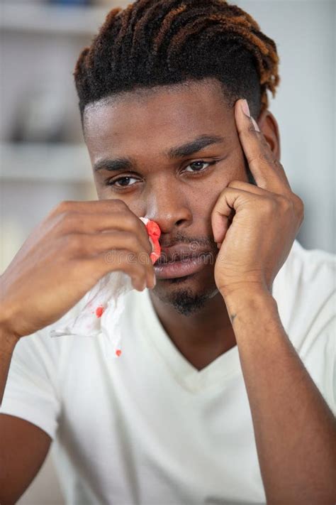 Young Man With Nosebleed Or Epistaxis Stock Image Image Of Polyps