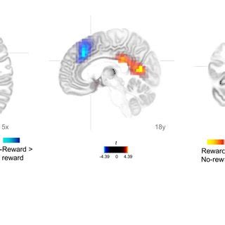 Source Localization Results Hot Colors Provide Activations Corrected Download Scientific