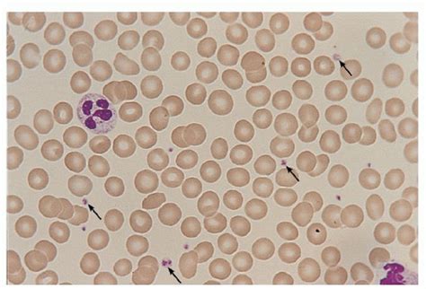 Platelet Structure And Function In Hemostasis And Thrombosis Oncohema Key