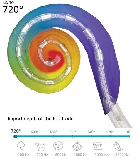Ci Manufacturers British Cochlear Implant Group