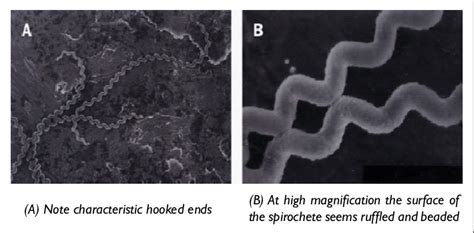High Resolution Scanning Electron Micrograph Of Leptospira Interrogans Download Scientific