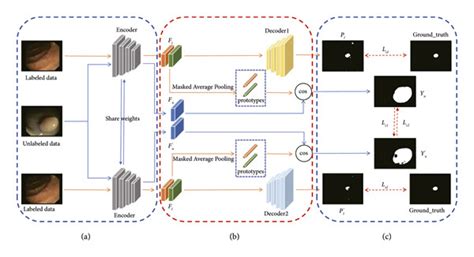 semisupervised medical image segmentation through prototype‐based