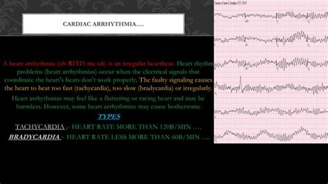 Common Signs And Abnormalities Can Detect In Cardiac Monitorpptx