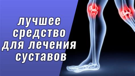 Мазь на змеином яде для суставов и крем обезболивающий для суставов ...