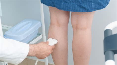 The Truth About Varicose Veins