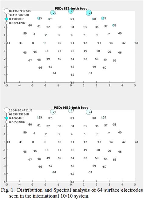 Dataset Contains Cortical Brain Activity Signals Recorded From 8 Download Scientific Diagram