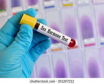 Alt Test Look Abnormalities Blood Blood Stock Photo Shutterstock