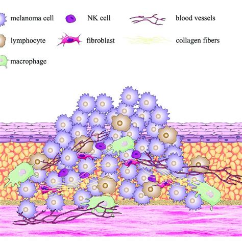 Formation Of The Multiple Melanoma Tumor Microenvironment Download