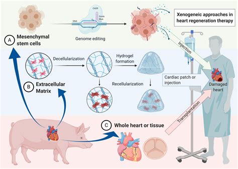 Xenotransplant: the amazing success of gene editing – IEEE Future ...