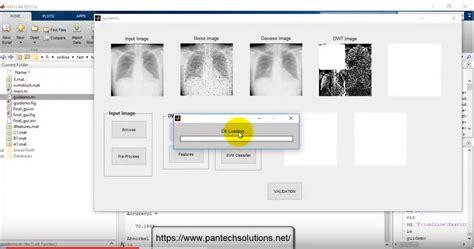 tuberculosis detection in xray images using matlab image processing