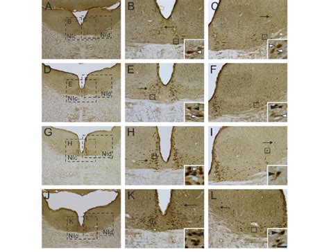 Representative Photomicrographs Of C Fos Expression In Relaxin 3 Ir