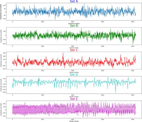 Epileptic Seizure Detection From Electroencephalogram Signals Based On