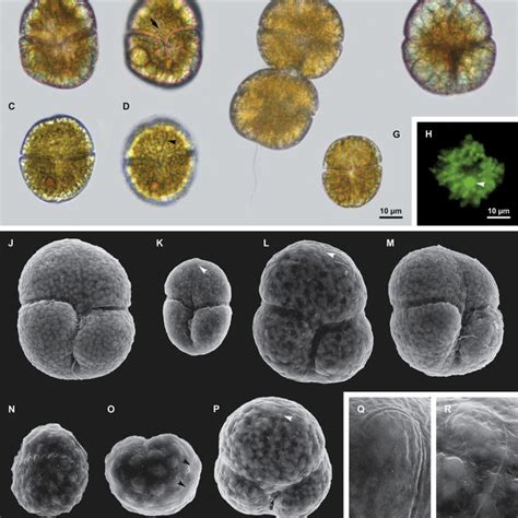 Pdf Taxonomic Clarification Of The Unusual Dinophyte Gymnodinium