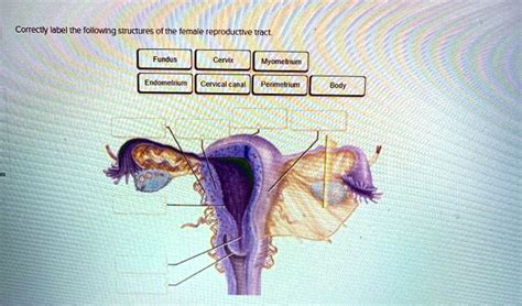 SOLVED Correctly Label The Following Structures Of The Female