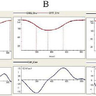 Volume Curve Of Left Ventricle Obtained From Left Ventricular Download Scientific Diagram