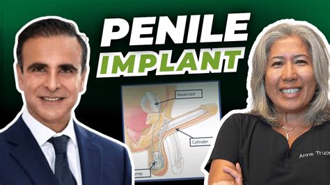 Penile Implant Explained Expert Advice From Top Urologist