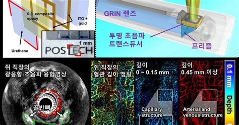 포스텍 연구팀 투명 초음파 광음향 내시경 세계 첫개발