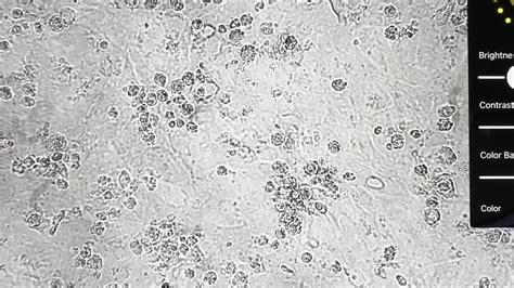 Anthony Essex Ph D On Linkedin Staring At These Beating Ips Derived Cardiomyocytes From