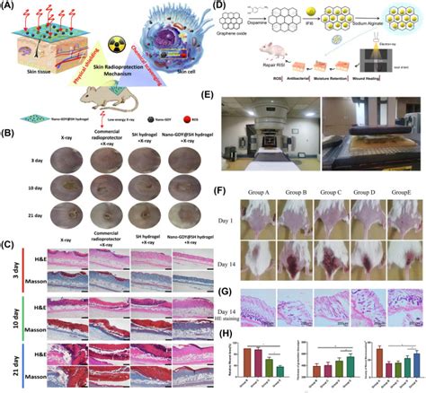 Nanozyme Engineered Hydrogels For Anti Inflammation And Skin