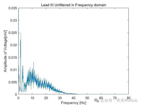 【心电信号】心电信号处理时域频域滤波 Qrs检测 心率检测附matlab代码 Csdn博客