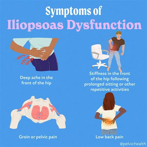 Iliopsoas Dysfunction Anatomy Symptoms And Treatments Phrc