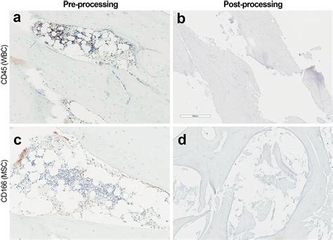 Representative Micrographs Of Ihc Staining For Bone Marrow Markers A