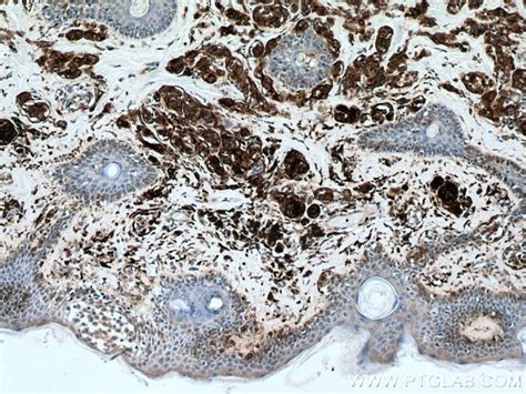 CD63 Antibody 25682-1-AP | Proteintech