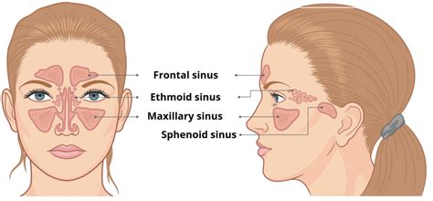 Paranasal Sinuses 1 Alastair Wilson