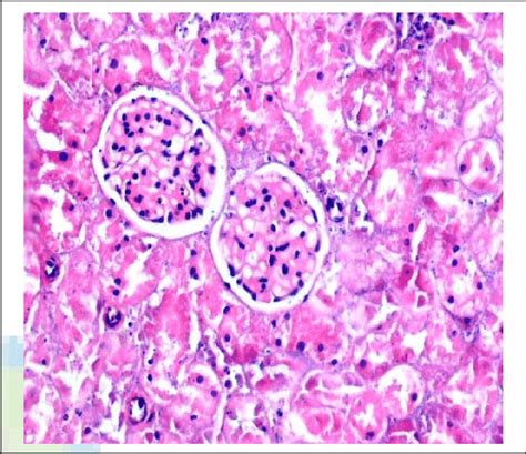 Photomicrograph From A Diabetic Control Rat Showing Diffuse Glomerular