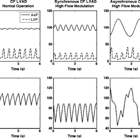 A Lvad Flow Waveform With A 40 Pulse Width B Lvad Flow Waveforms