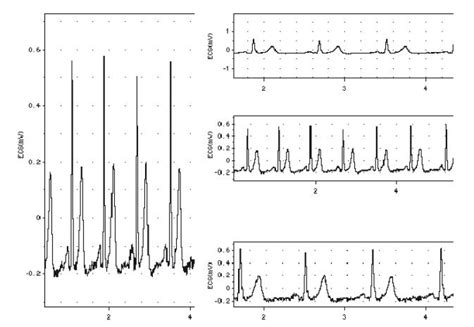 Basics Of Data Acquisition Edaq Wiki