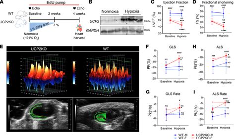 Ucp2 Ablation Decreases Cardiac Function In Adult Mice Under Hypoxia