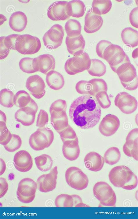 Segmented Neutrophils