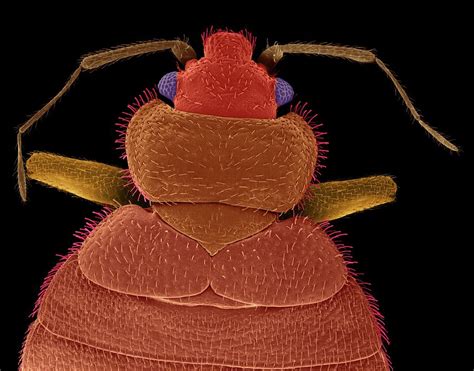 Bed Bug 7 Photograph By Dennis Kunkel Microscopy Science Photo