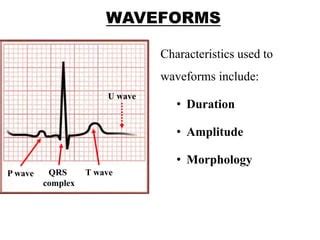 3 Ecg Basics Waveforms Segments Intervals Pptx