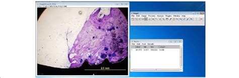 Bic Percentage Measured With Imagej Analysis Software Download