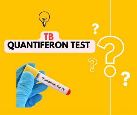 Quantiferon Test Qft For Tuberculosis Dr Ankit Parakh Indias Best Pediatric