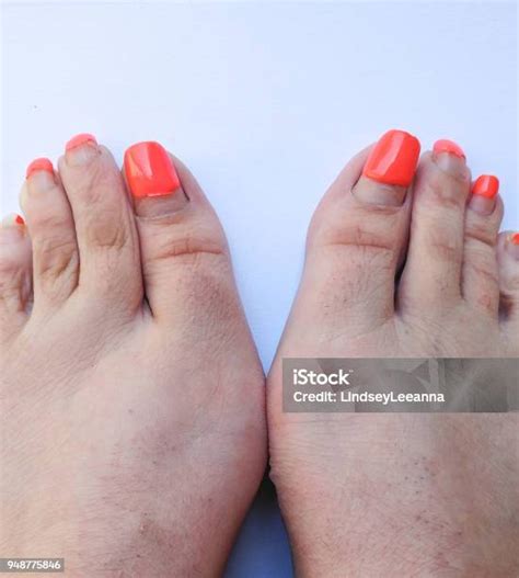 심하게 못생긴 여자의 발 긴 연어 색된 발톱을 신랑 페디큐어가 필요 합니다 연체 페디큐어입니다 흰색 배경에 고립 건강관리와 의술에 대한 스톡 사진 및 기타 이미지 Istock