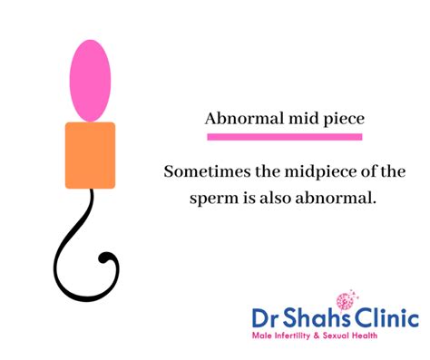Abnormal sperm morphology explained - its meaning and implications