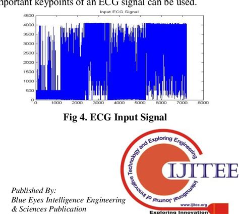 Figure 4 From An Efficient Method For Secure Ecg Feature Based