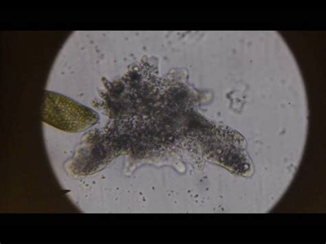 Amoeba Under Microscope 100x Labeled