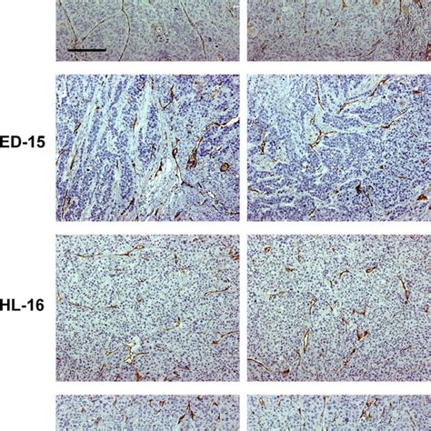 A Doxycycline Regulated Me180 Cervix Carcinoma Cell Line With Inducible Download Scientific