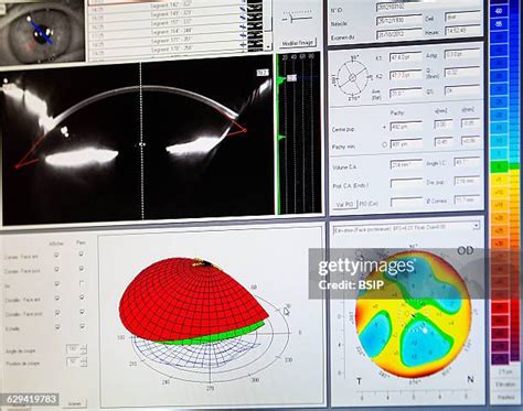 Corneal Topography Photos And Premium High Res Pictures Getty Images
