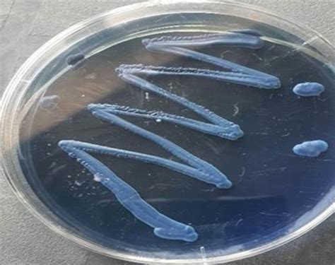 Growth Of C Neoformans On Cryptococcus Differential Agar After 10 Days