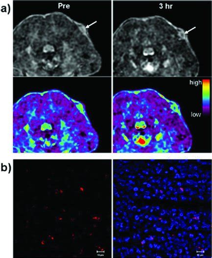 Scheme 3 Intracellular Trafficking Of Mesoporous Silica Nanoparticles
