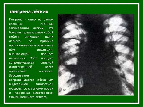 Атлас рентгеновских снимков с описанием - презентация онлайн