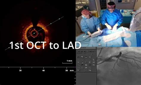 Stephane Carlier On Linkedin New Year New Project And Picture