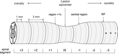 Schematic Illustration Describing Spinal Cord Sampling Generally For